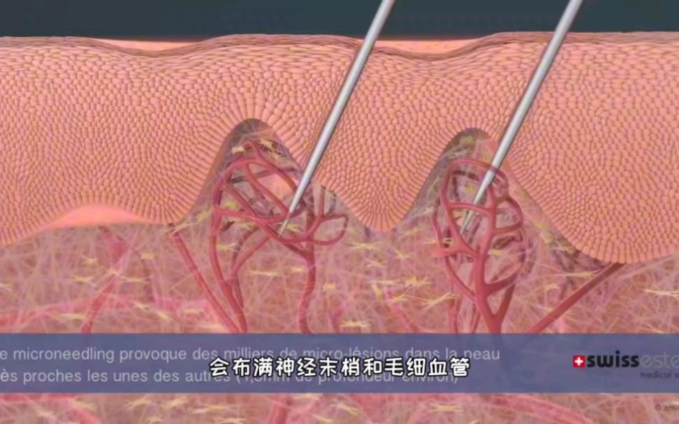 为什么多细的针扎手都会疼,3D演示。