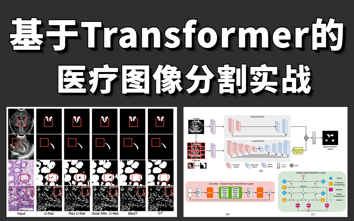 ...Transformer的医学图像分割实战,论文精读+源码复现,看完就能跑通!