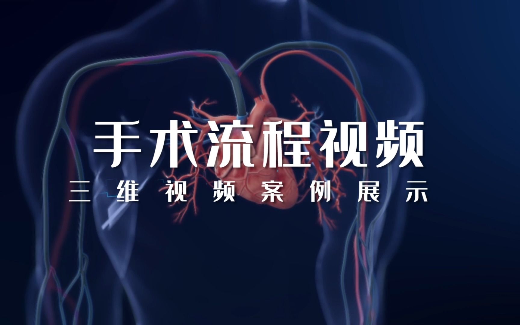 上海专业医学视频制作.PCI手术流程视频