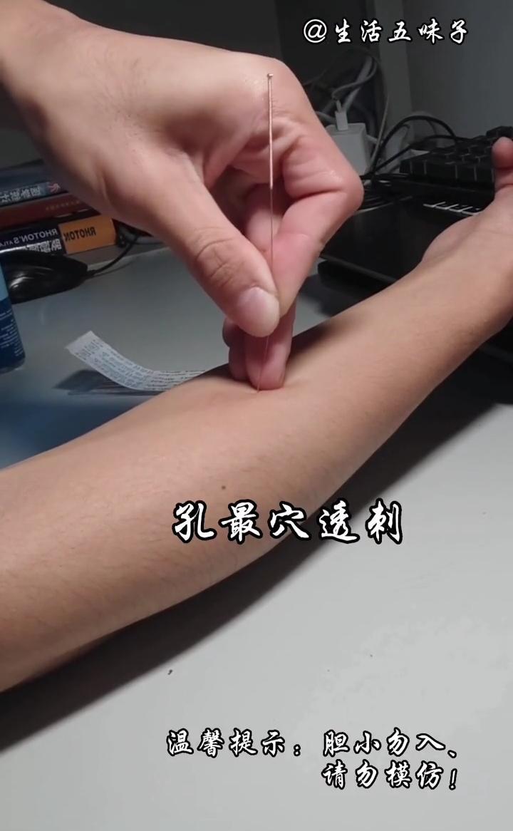 孔最穴透刺