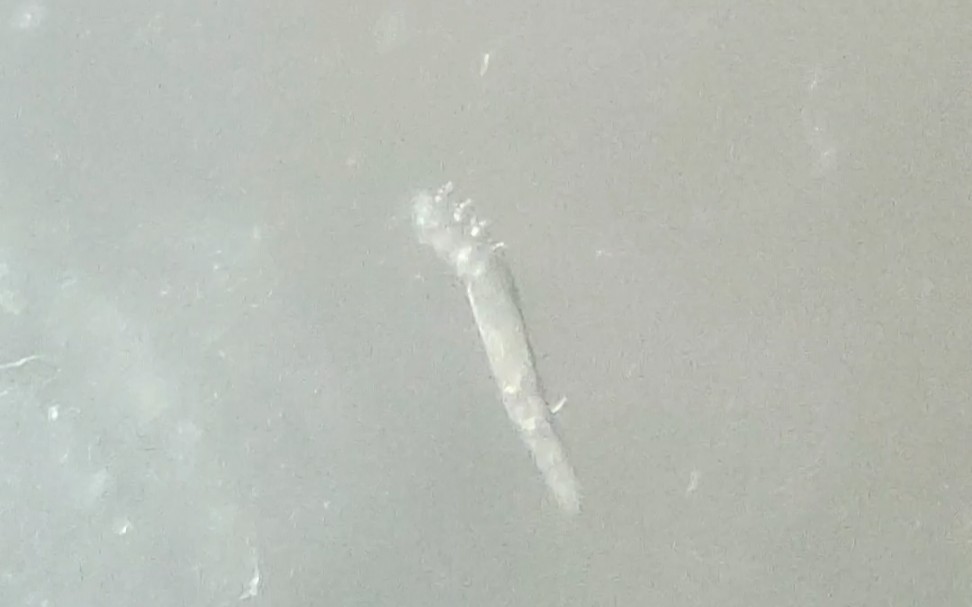 蛄蛹着的毛囊蠕形螨(其实还怪可爱的)