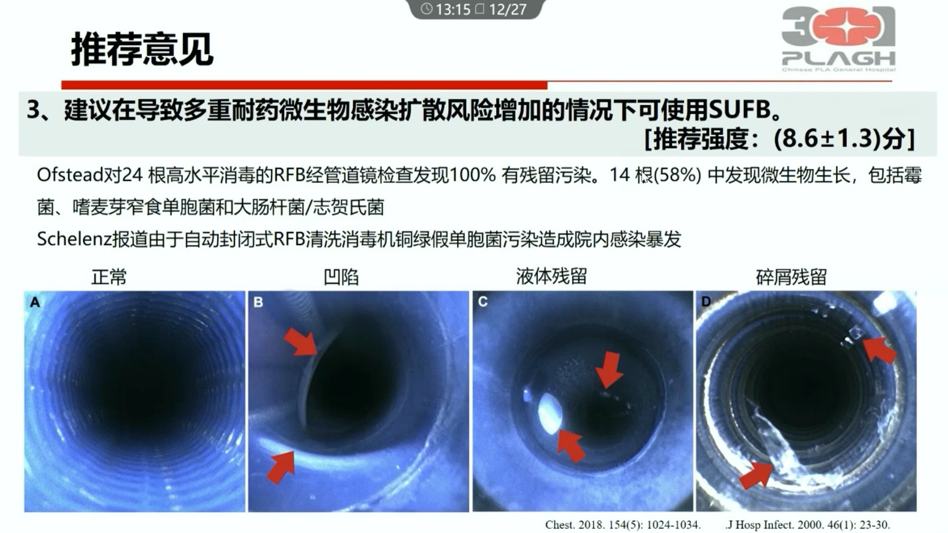 8.1 ICU一次性软性支气管镜应用专家共识解读