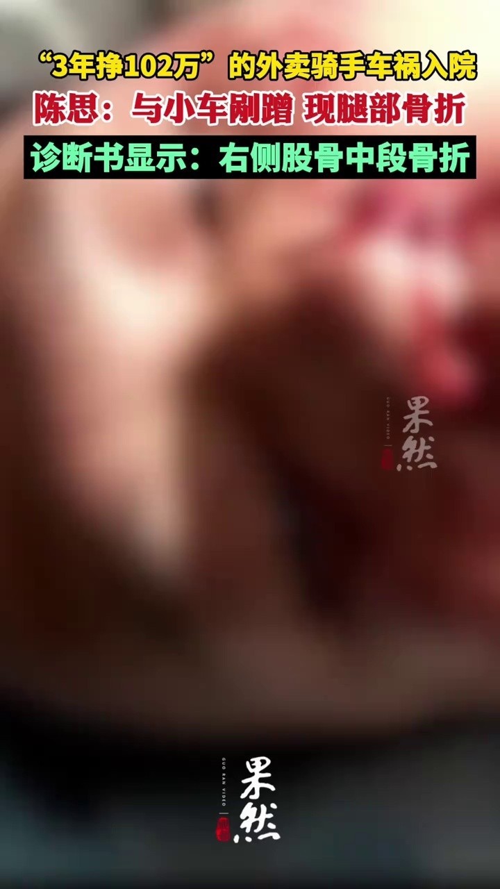 "3年挣102万"的外卖骑手发生车祸 本人:与小车剐蹭,现腿部骨折