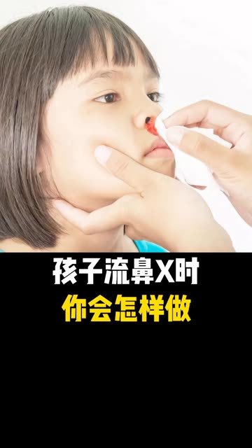 孩子流鼻血,别再仰头、塞纸巾了!正确止血方法是这3种