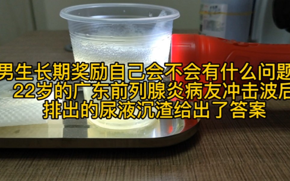 ...什么问题?22岁的广东前列腺炎病友冲击波排出浑浊尿液给出了答案。