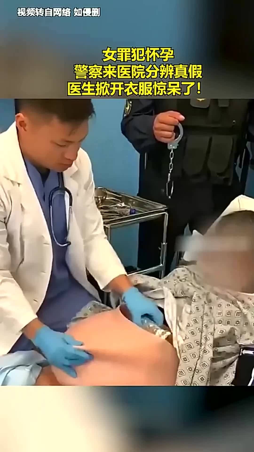 女罪犯怀孕,警察来医院分辨真假,医生掀开衣服惊呆了!