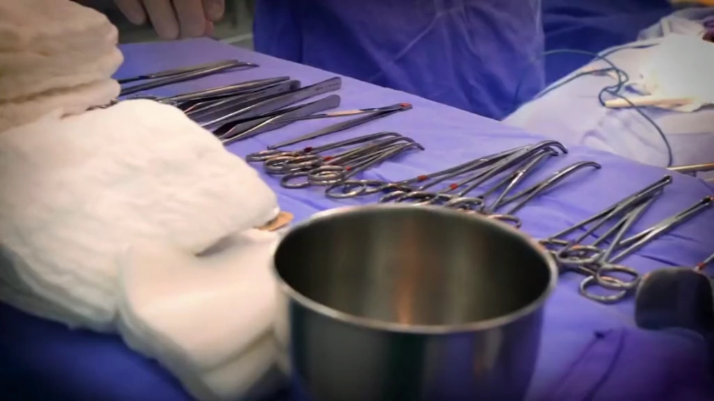 产房实录孕妇剖腹产分娩全过程,剖腹产妈妈的付出令人肃然起敬!