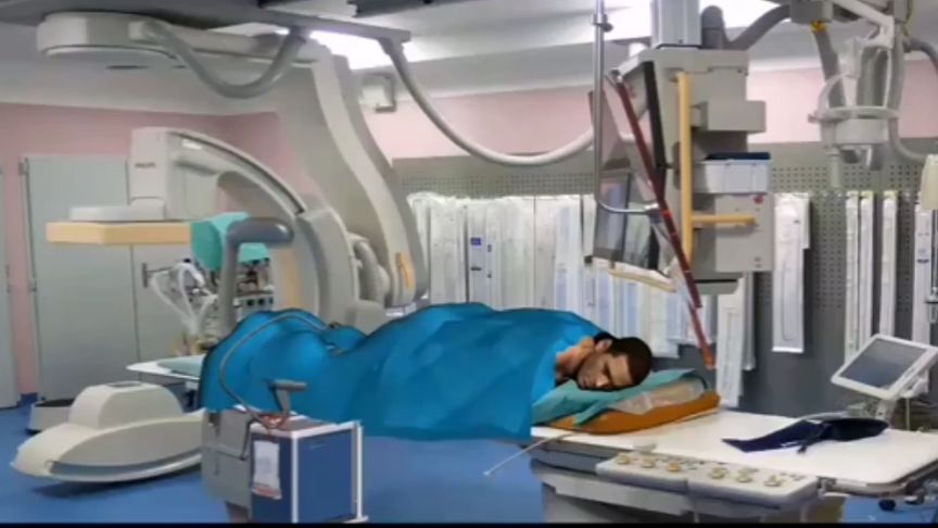 医学3D动画演示:动脉粥样硬化血栓切除术