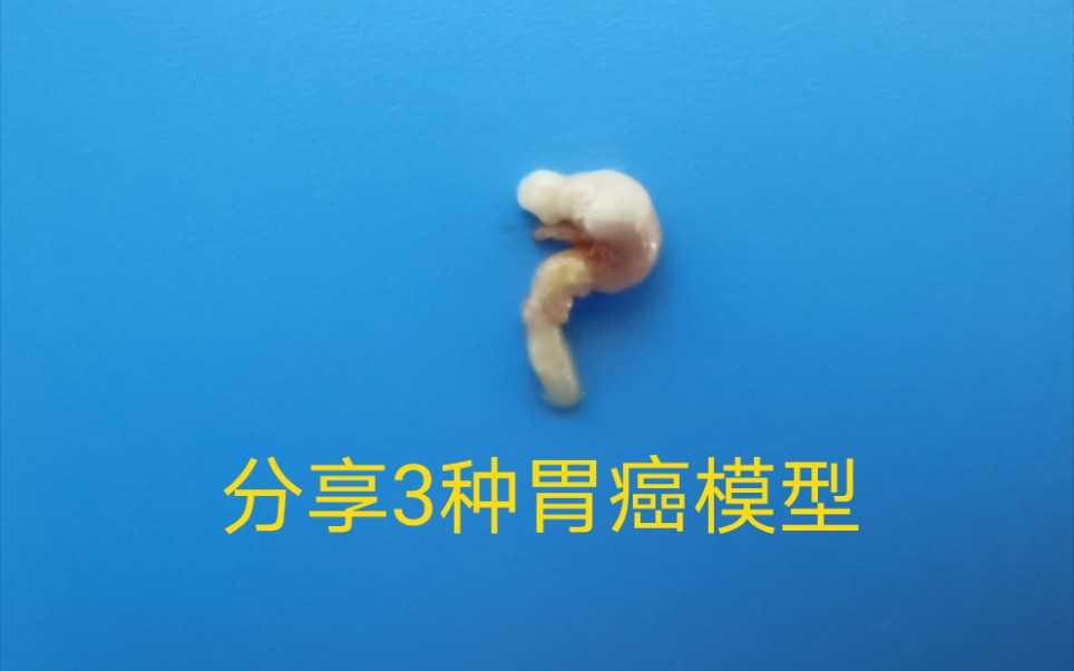 分享3种胃癌模型建立方法