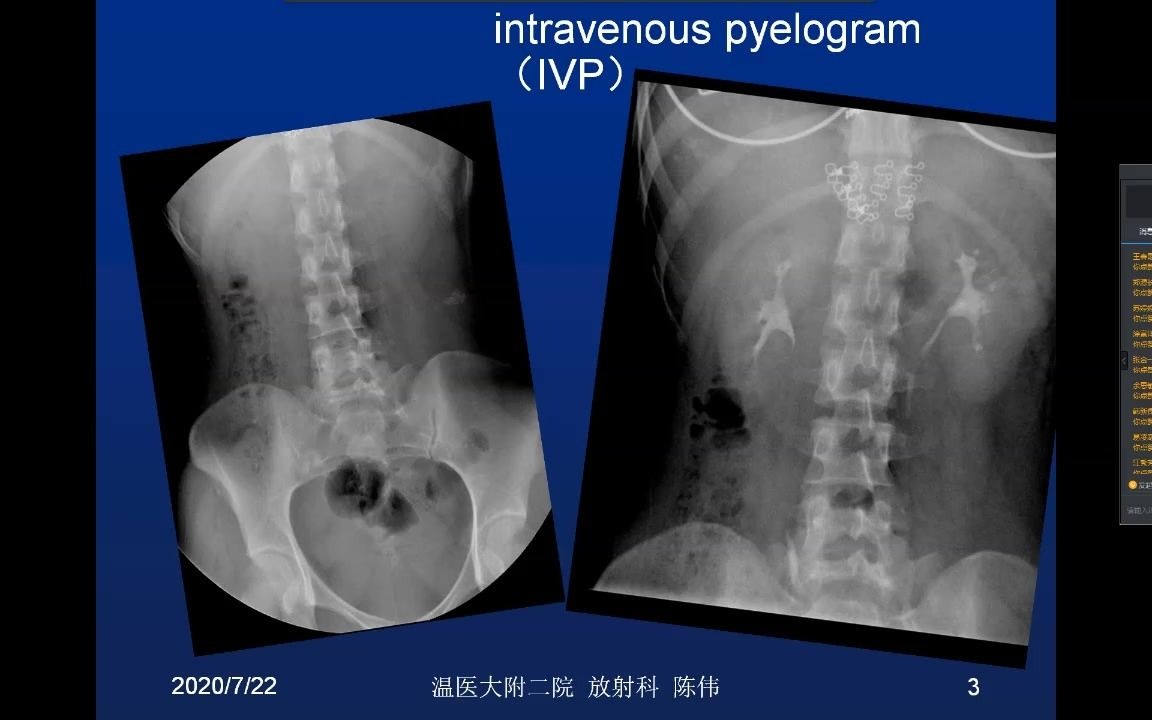 温州医科大学附属第二医院放射科陈伟——住院医师规范化培训课程《...