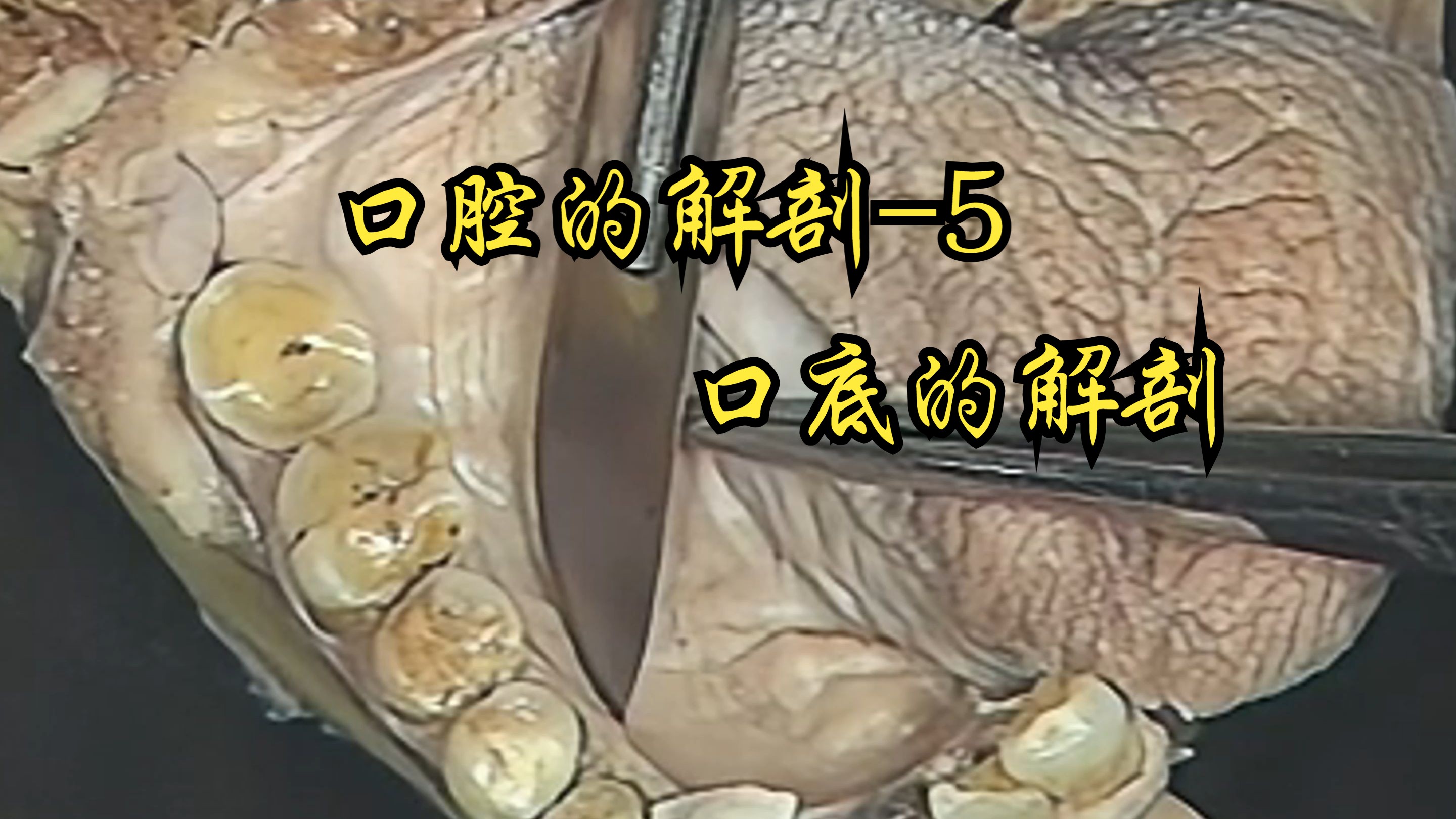 局解实操-口腔的解剖-5(舌下腺、下颌下腺导管与舌神经)