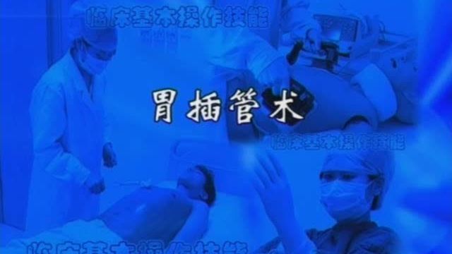 胃插管术教学视频