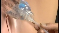 子宫颈扩张球囊导管