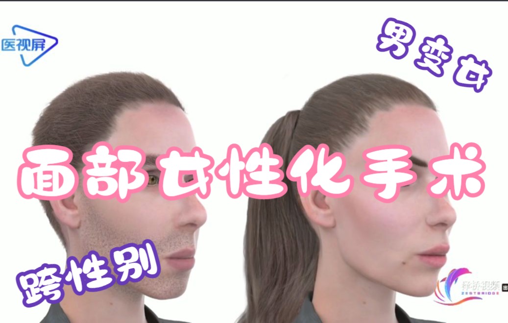 【医学3D】:变性人是如何从阳刚脸变成软妹脸的?