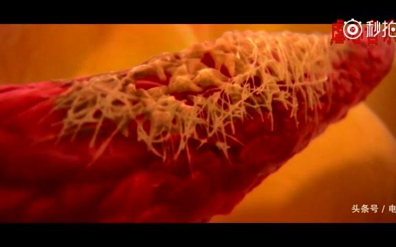 伤口愈合全过程