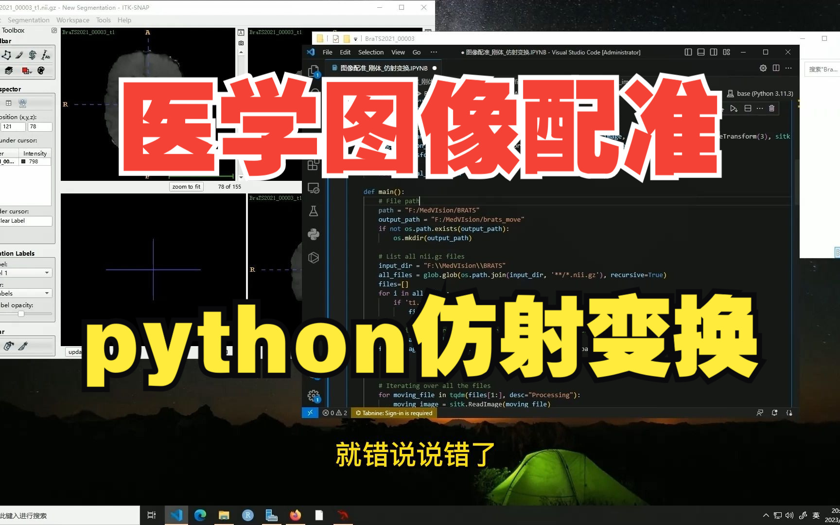 医学图像数据处理-预处理医学图像配准python实战