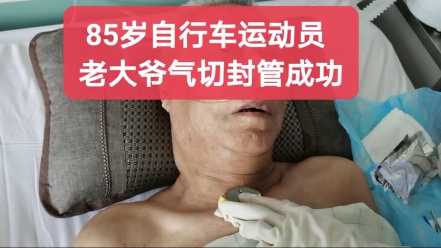 85岁大爷,脑出血气切封管成功了。