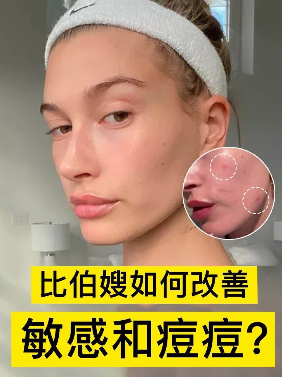 北大皮肤科老师:换季敏感和痘痘,请做这3件事!#敏感肌 #痘痘 #护肤 #...