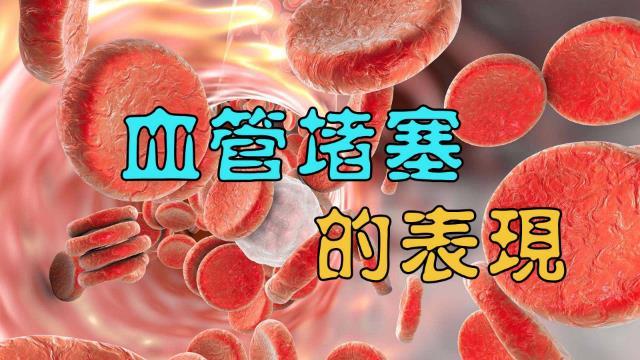 血管堵没堵,看身体的哪些地方能看出?转给自己的家人看