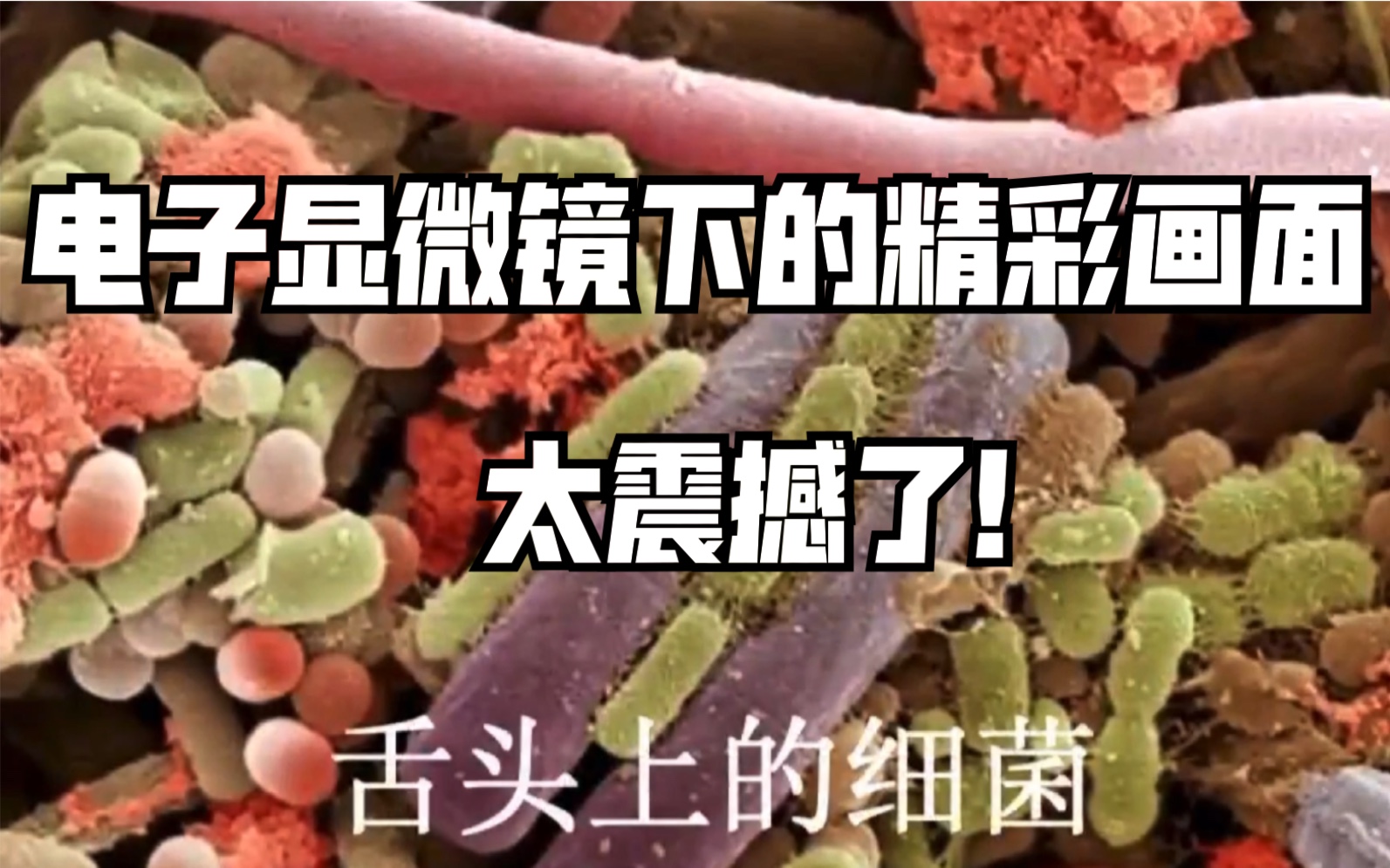 【超酷医学视频 】电子显微镜下的精彩画面,太震撼了!