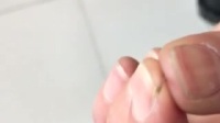 盲人针使用方法