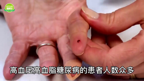 血管堵了100%,一定要做支架?心内科专家的回答有点意外