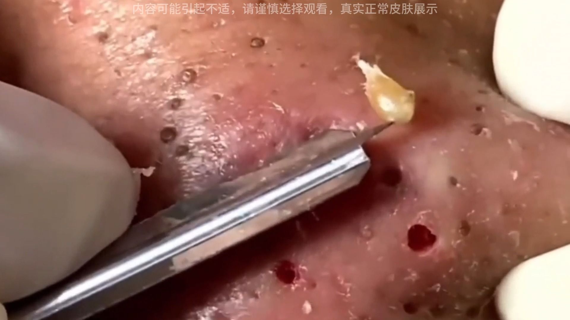 沉浸式 矿产资源丰富 论护肤的重要性