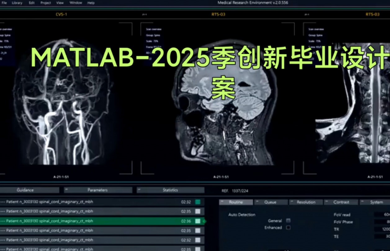 matlab设计方案2025季毕业设计热门方案分享