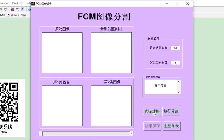 MATLAB图像分割系统