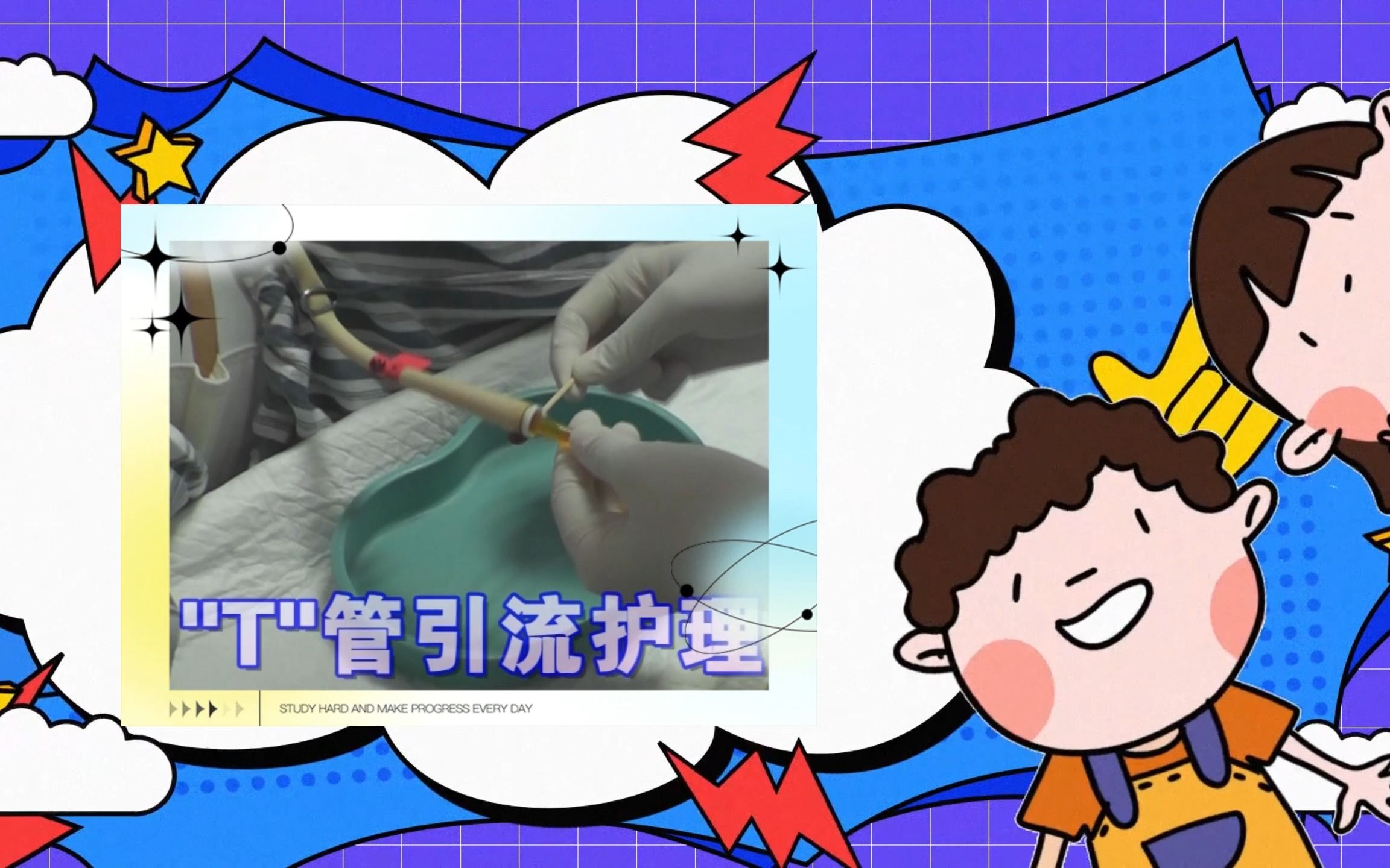 【最新版】临床护理50项技能操作视频“T型管引流护理”
