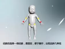 BD动脉采血操作--新生儿