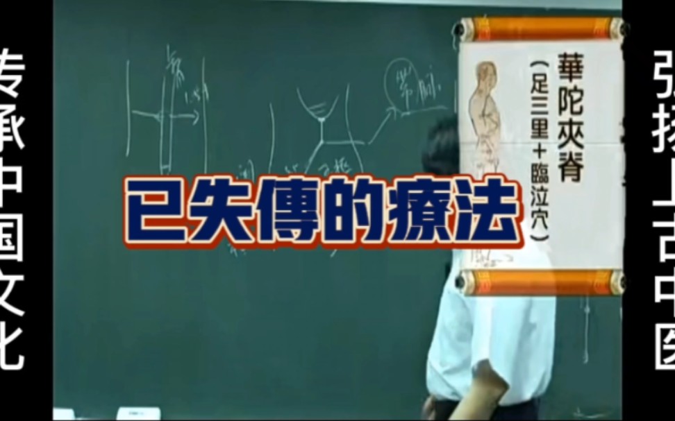 倪师教你华佗夹脊痛已失传的疗法:只需在这两个穴位上下针