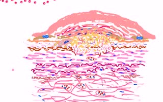 3D医学动画:《外科学动画》