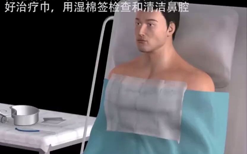 如何坐位插鼻饲管