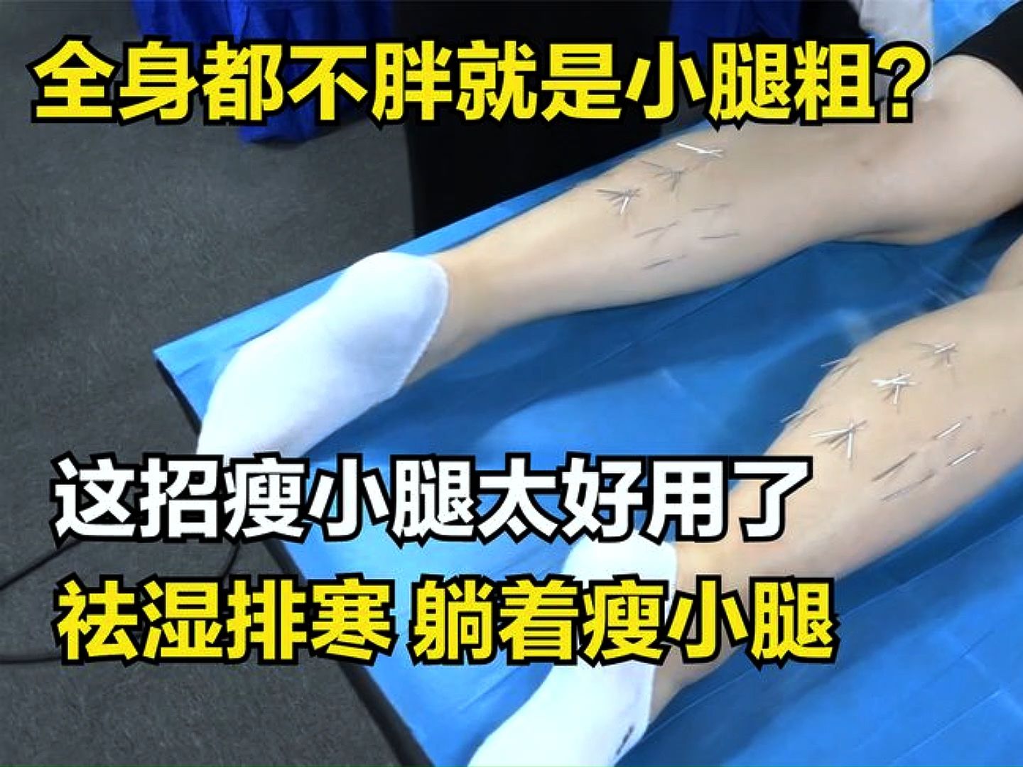 ...小腿粗?这招瘦小腿太好用了,祛湿排寒躺着瘦小腿!王瑞雪汉传针雕!