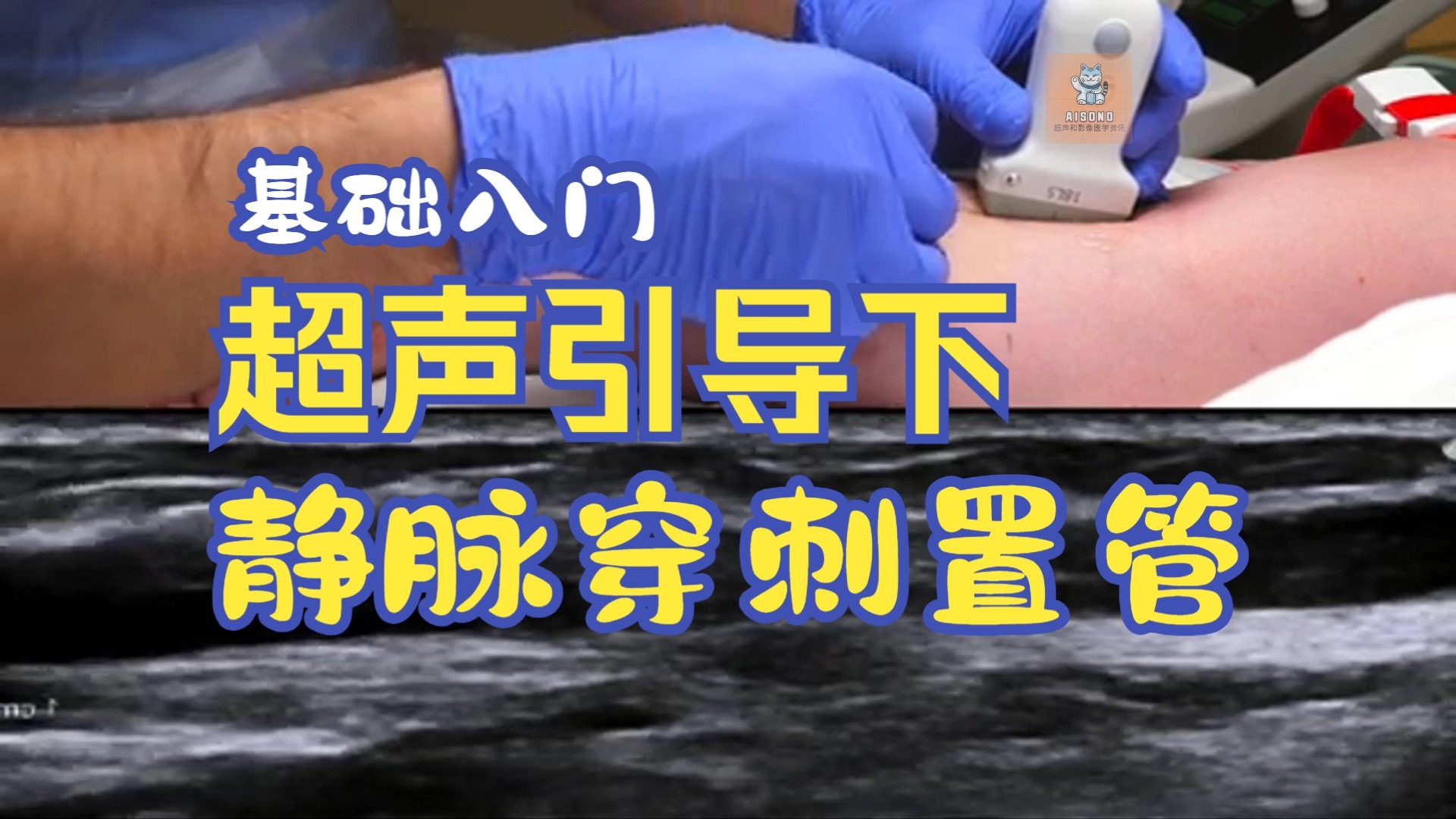 超声引导下外周静脉穿刺置管-3分钟基础入门--视频标注+图解辅助+...