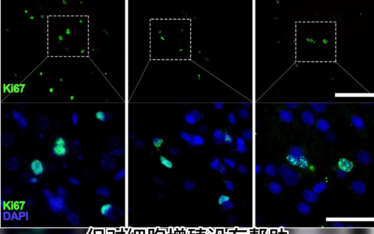荧光显微镜揭示布洛芬新用途