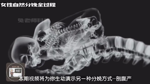 剖腹产高清三维动画演示妈妈的不易和伟大