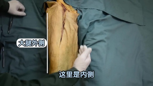 你好,这是一期关于人类大腿解剖的详解视频大体老师知识科普