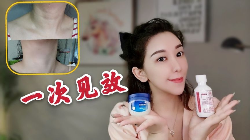 颈纹深怎么办?巧用维E乳⁺凡士林,成本便宜见效很快,建议收藏