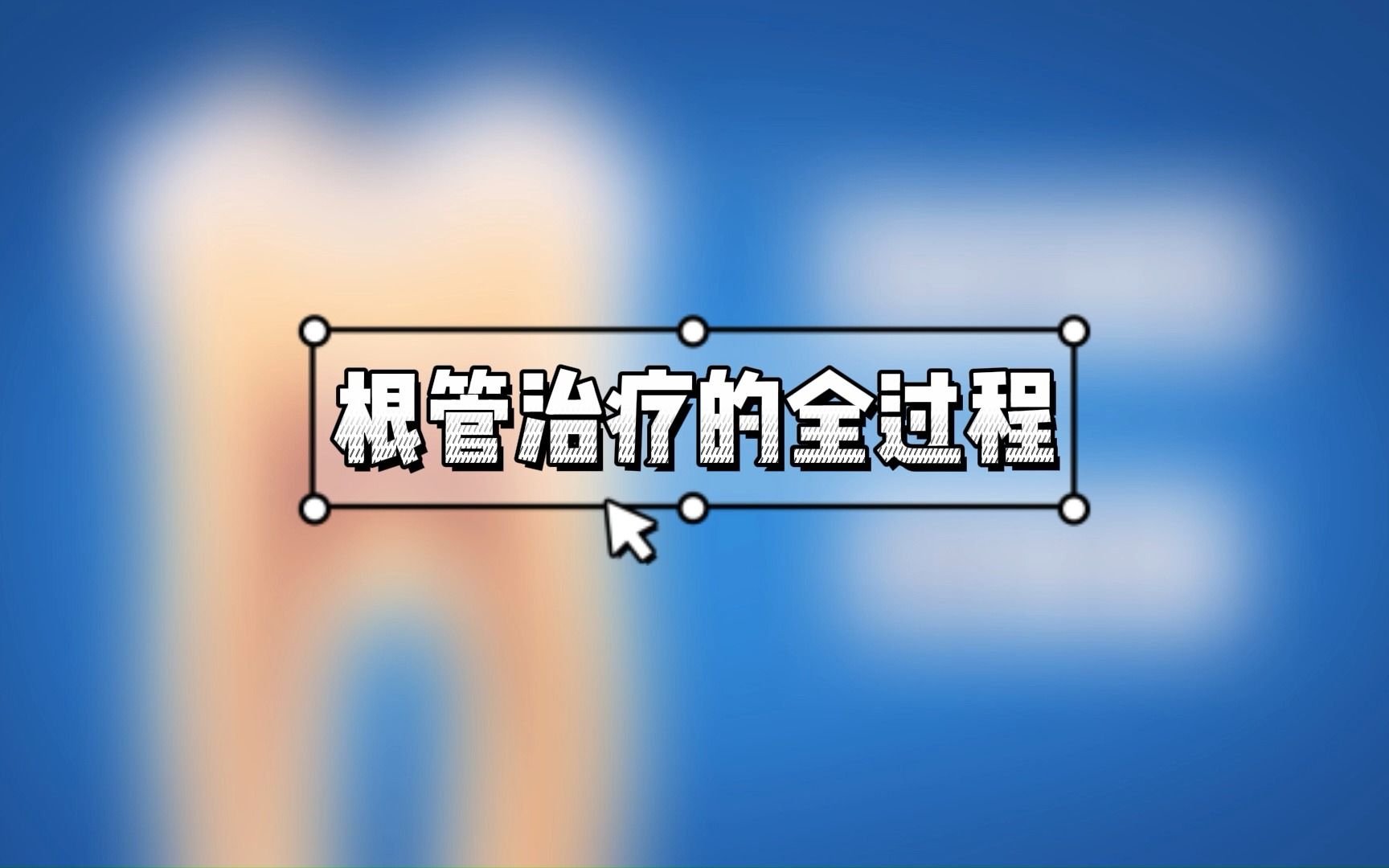 根管治疗全过程
