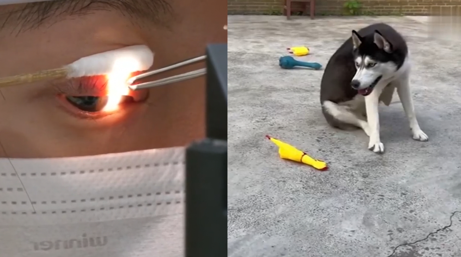 母女俩眼睛干涩发痒,到院后医生检查一看:眼睑里有几百条螨虫