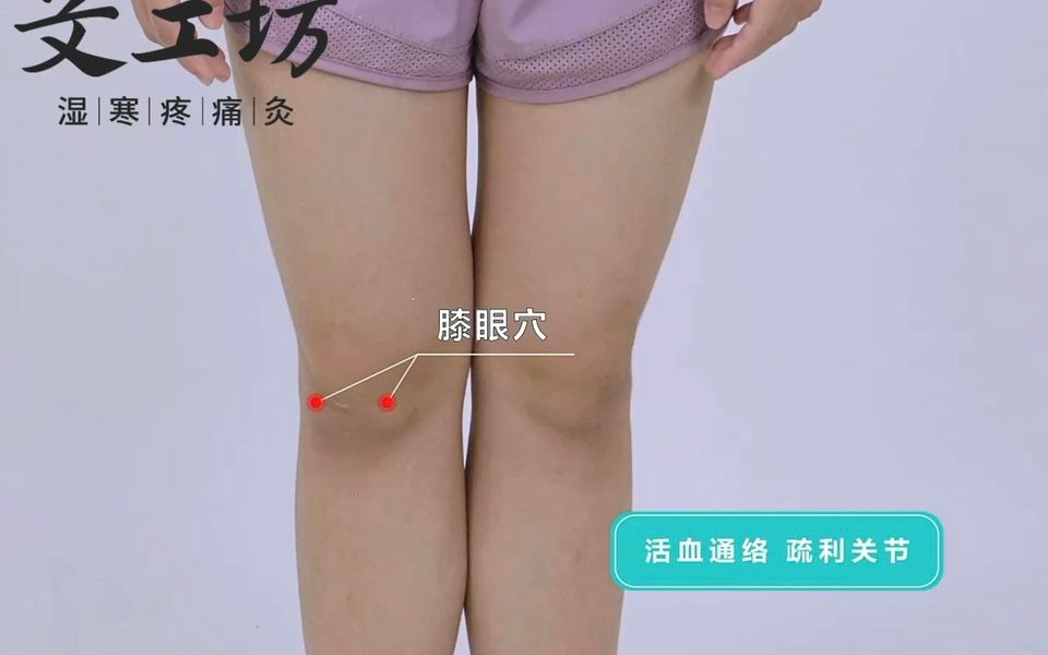 膝关节疼痛的特效穴———膝眼穴