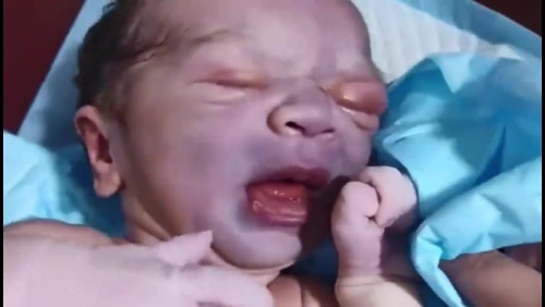 宝宝出生瞬间,妈妈惊恐与喜悦交织,究竟发生了什么惊人画面?