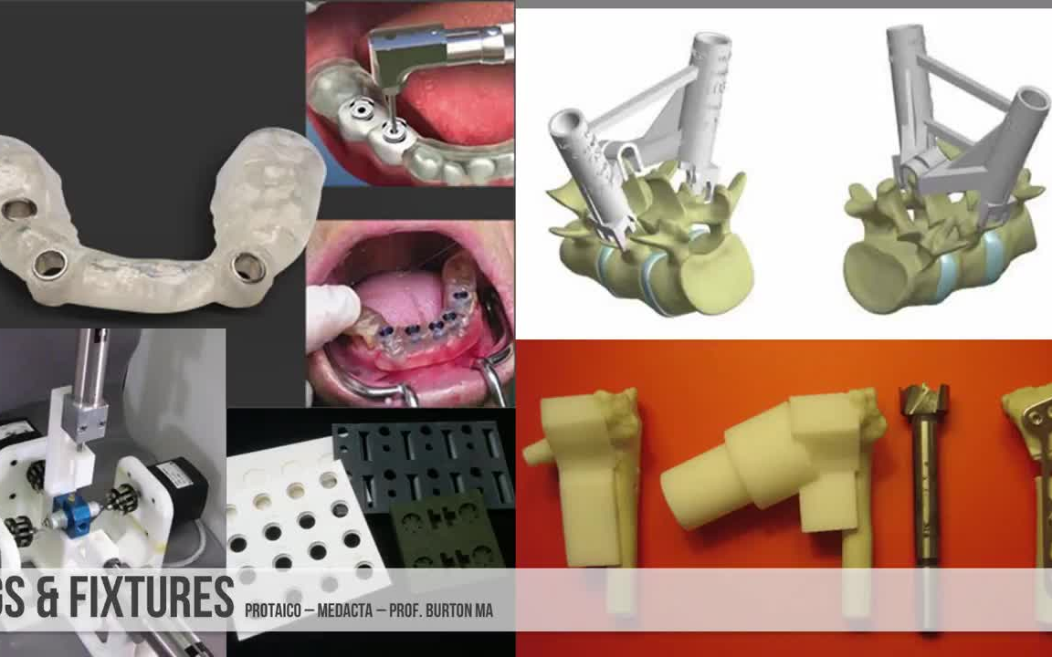 【3D打印】超详细,3D打印在医疗领域的应用