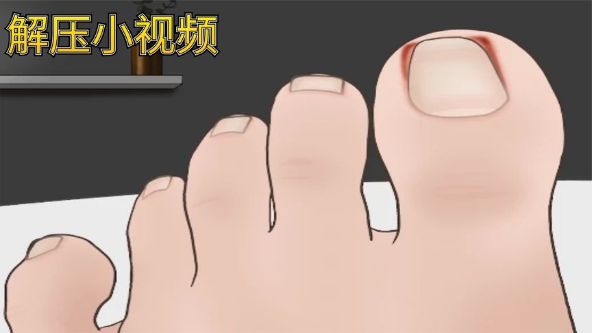 定格的动画,修剪脚指甲,展现一个完美的脚指甲。