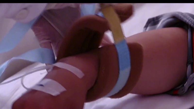 男子被狗咬了,只是用二锅头清理一下伤口,一个月后病发身亡