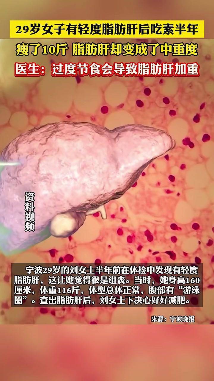 ...脂肪肝却从轻度变成了中重度!医生:过度节食会导致脂肪肝加重#减肥...