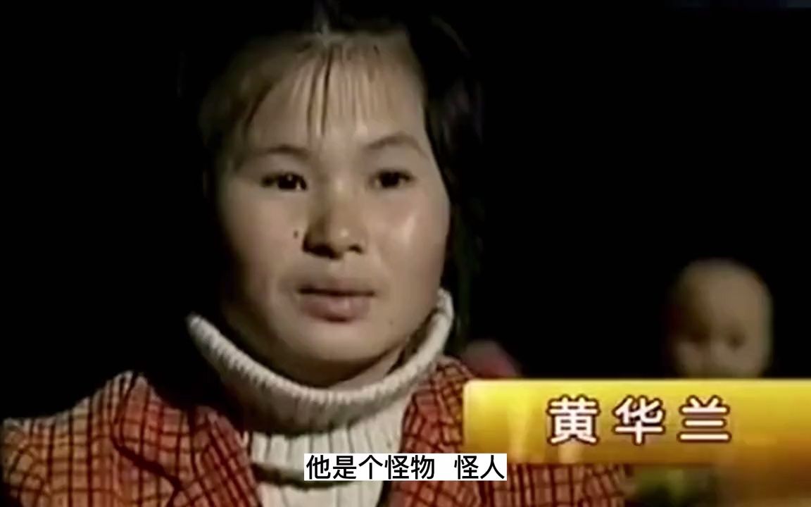 女子诞下一名“奇婴”,出生背后竟长出一条尾巴,吓坏父母和医生