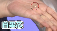 白果虽有化痰平喘作用,但是用量上要适量,中毒要赶紧送医